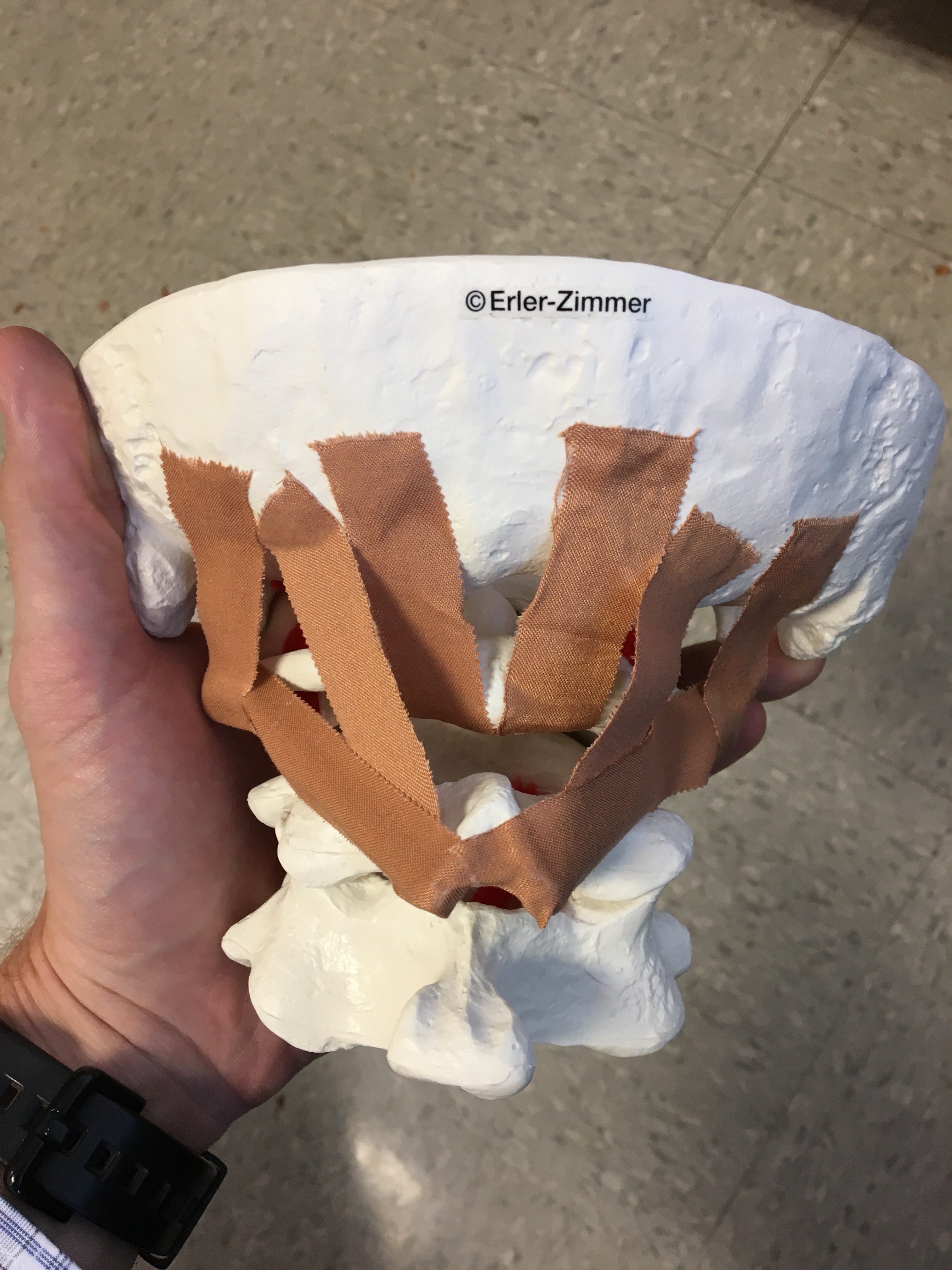 Having fun with an upper cervical model | Manual Therapy Forum